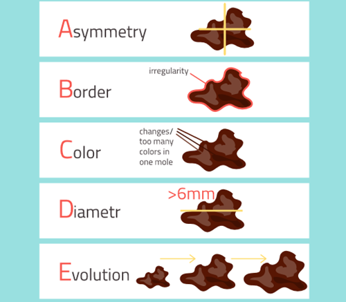 Skin cancer: signs and symptoms in older patients